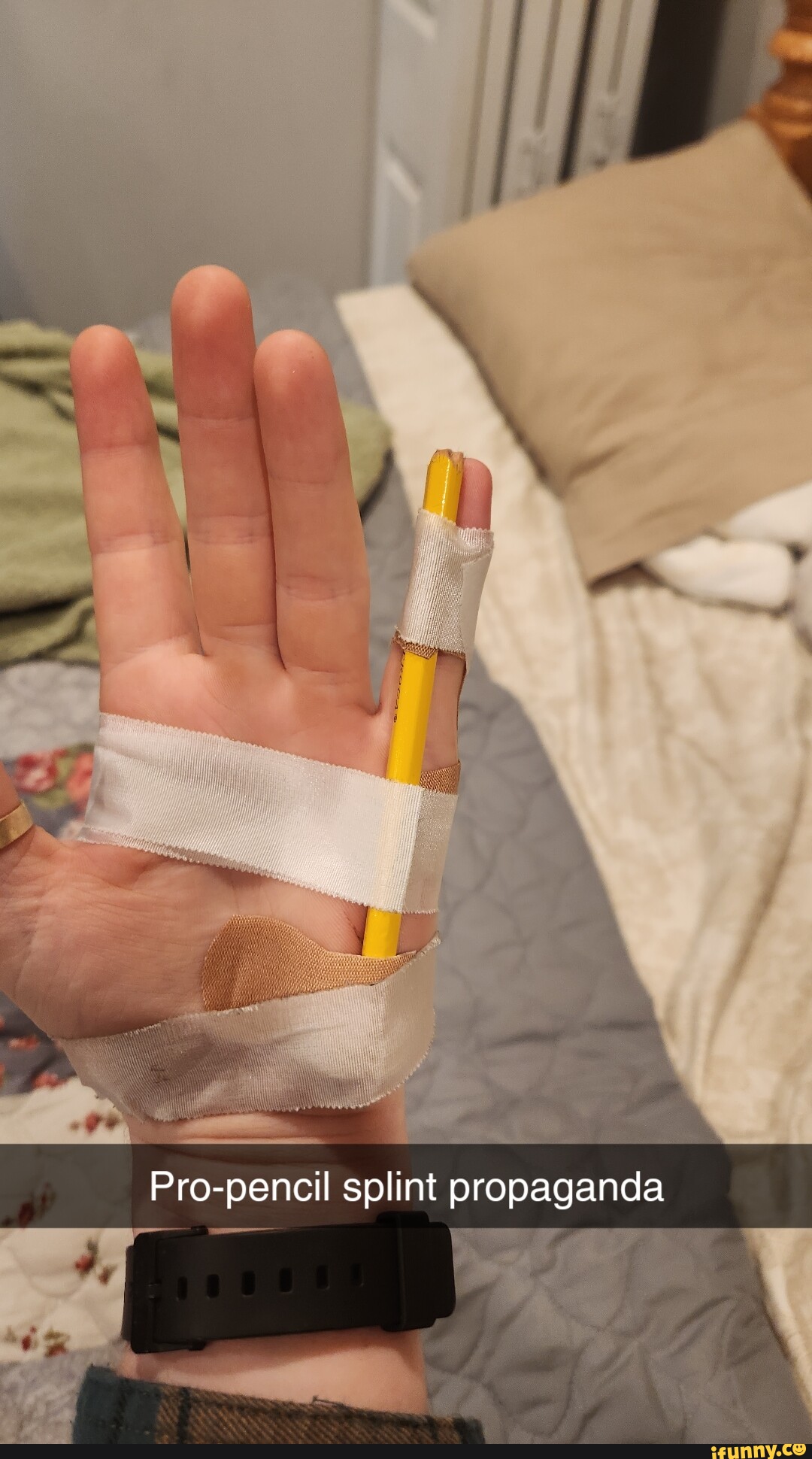 Splint memes. Best Collection of funny Splint pictures on iFunny