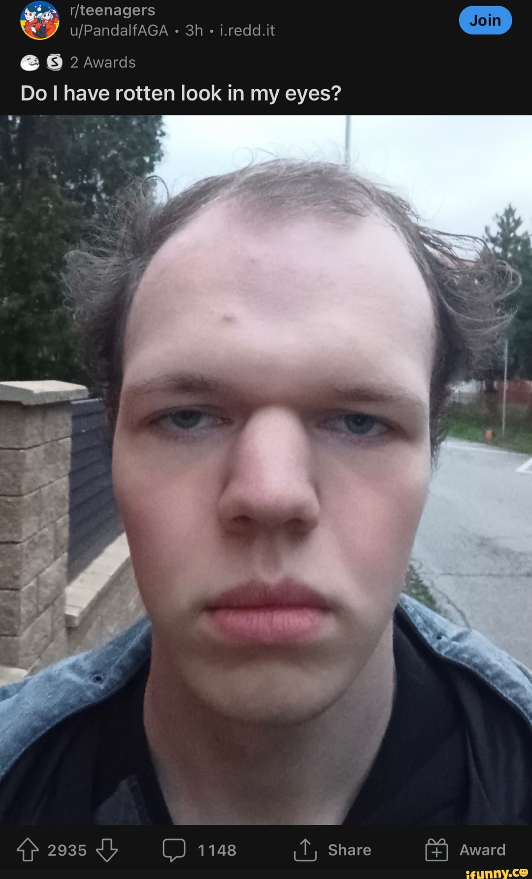 I.redd.it 2 Awards Do I have rotten look in my eyes? Ne qp 2935 1148 ...