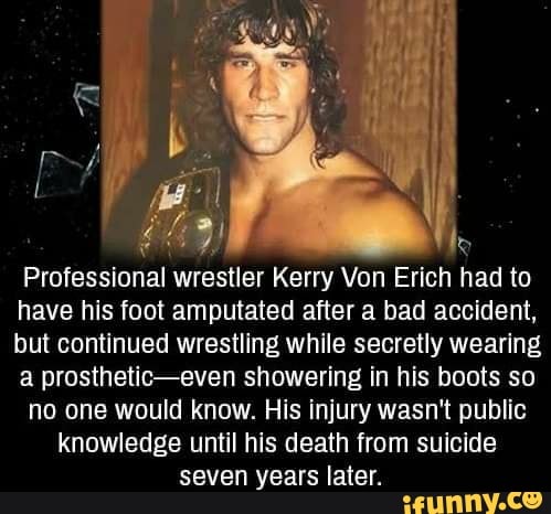 Professional wrestler Kerry Von Erich had to have his foot amputated ...