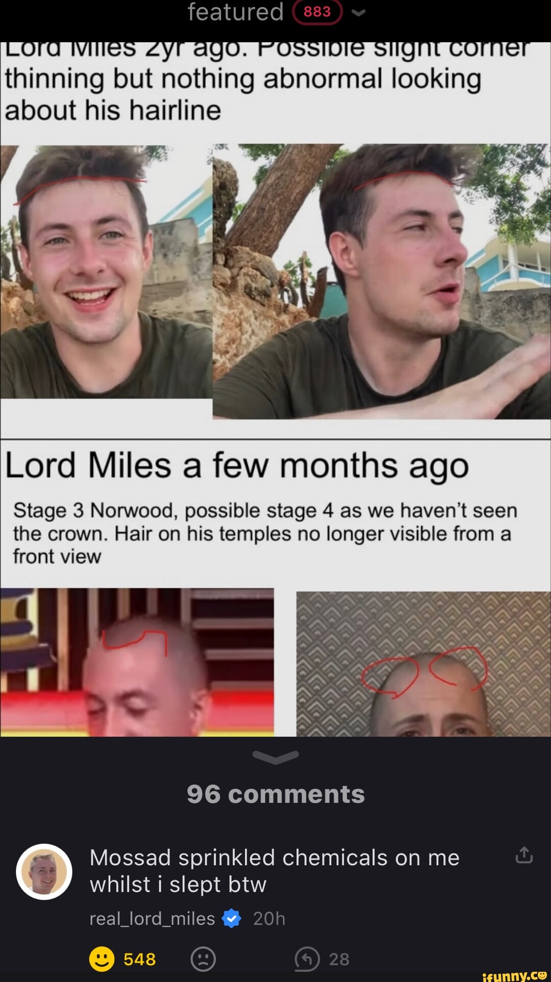 Abnormal memes. Best Collection of funny Abnormal pictures on iFunny