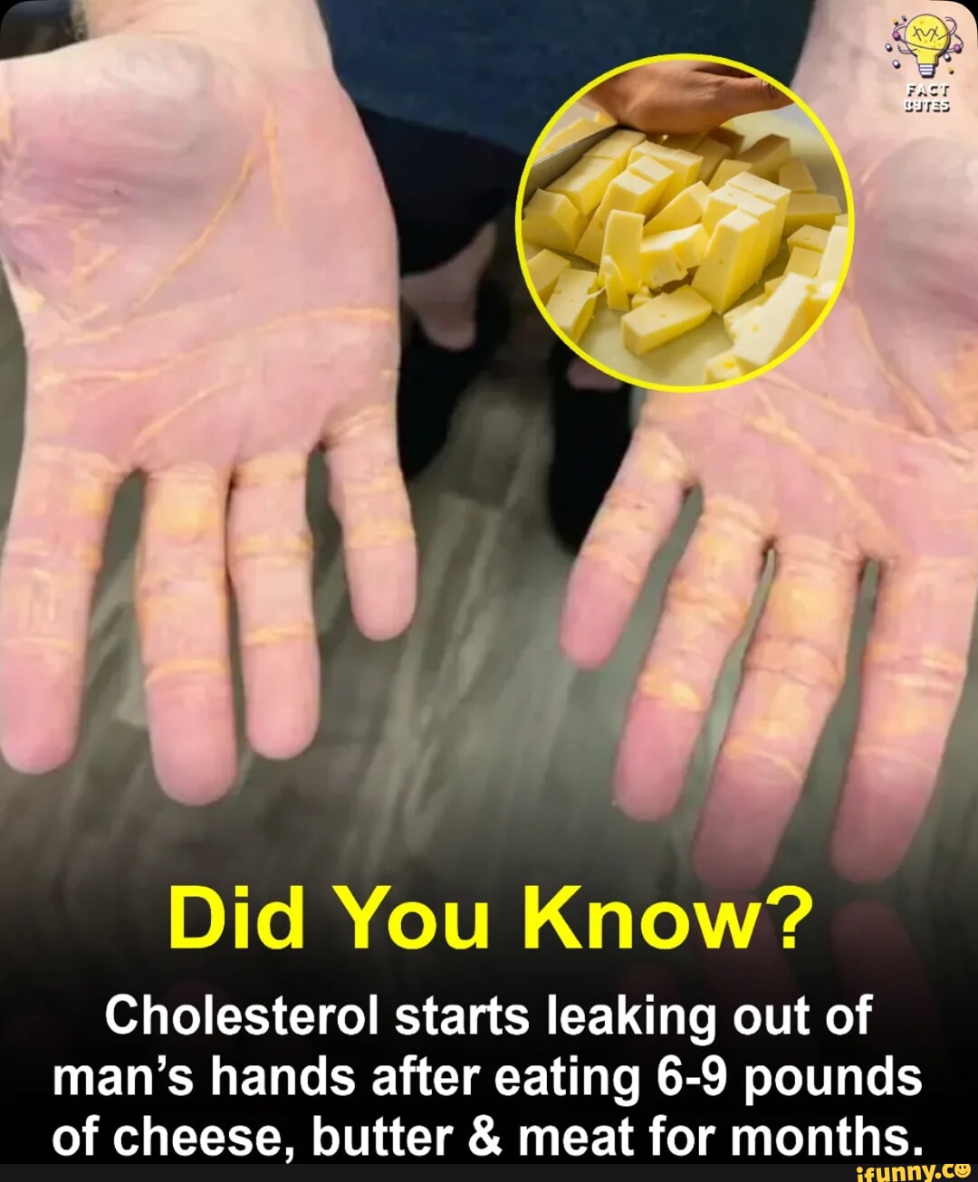 Did You Know? Cholesterol starts leaking out of man's hands after ...