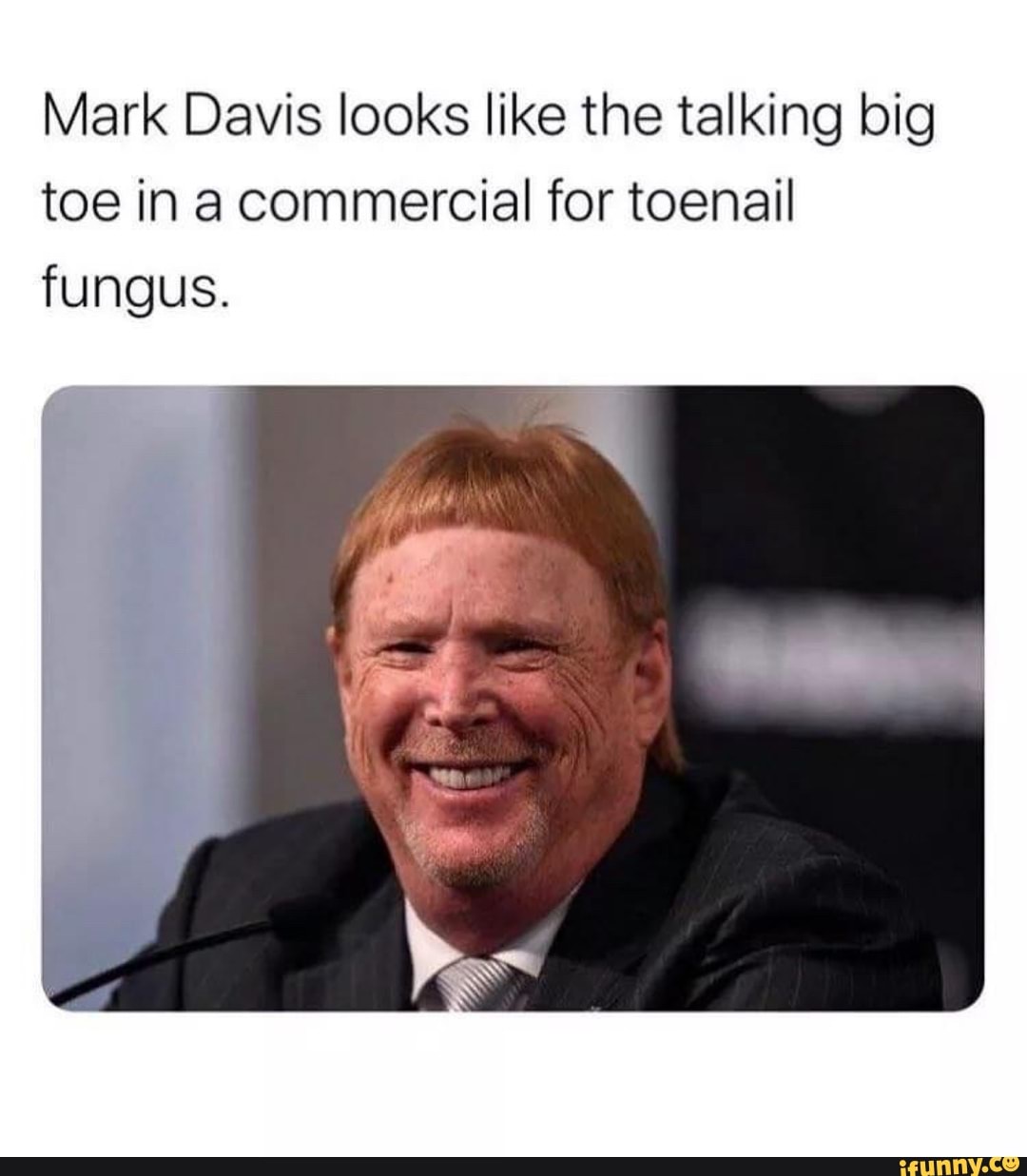 Mark Davis looks like the talking big toe in a commercial for toenail ...