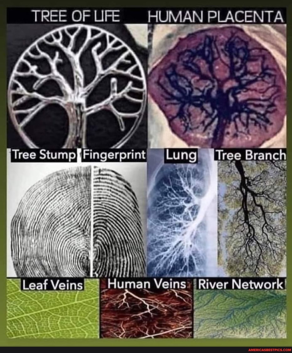 TREE OF LIFE HUMAN PLACENTA Human Veins {Rive - America’s best pics and ...
