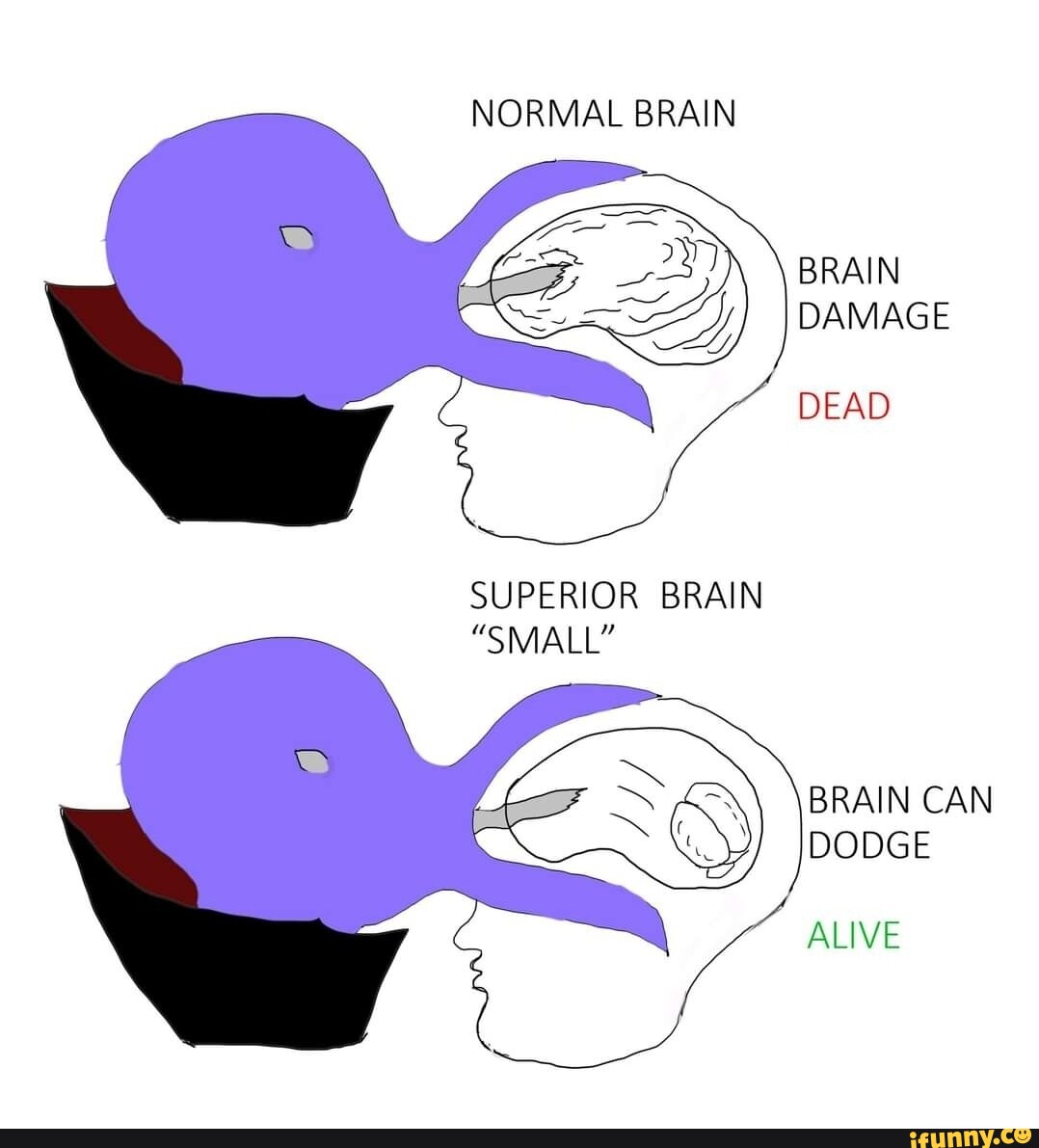 NORMAL BRAIN 2) SUPERIOR BRAIN "SMALL" BRAIN DAMAGE DEAD BRAIN CAN ...