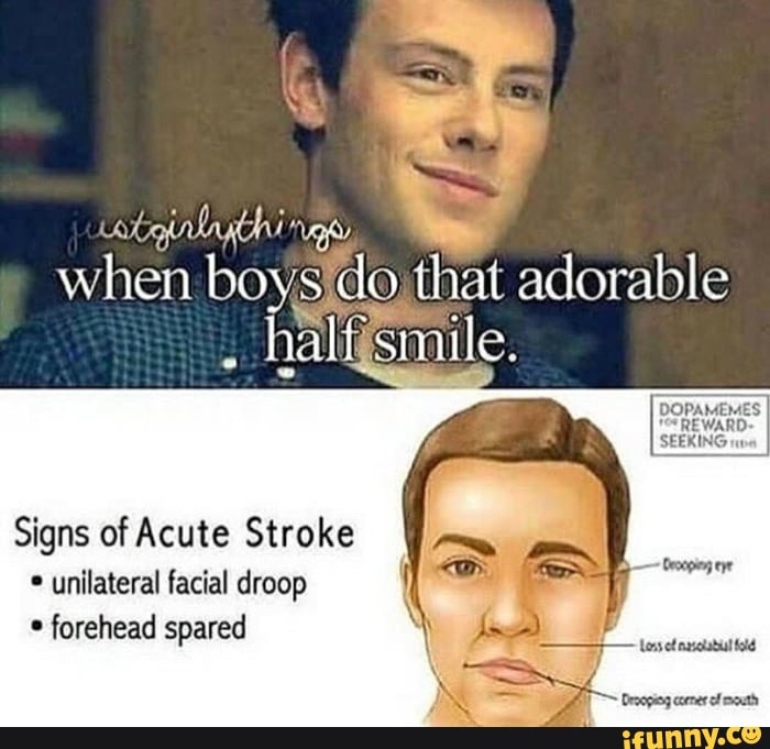 That adorable half smite Signs of Acute Stroke * unilateral facial ...
