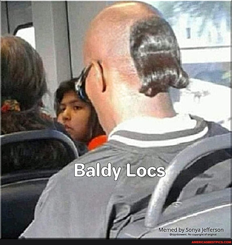 Baldy Loes Memed by Sonya Jefferson - America’s best pics and videos
