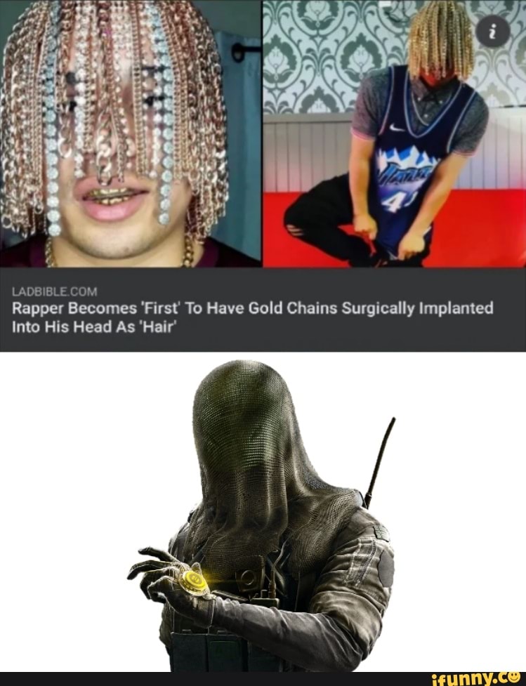Rapper Becomes First To Have Gold Chains Surgically Implanted Into His ...
