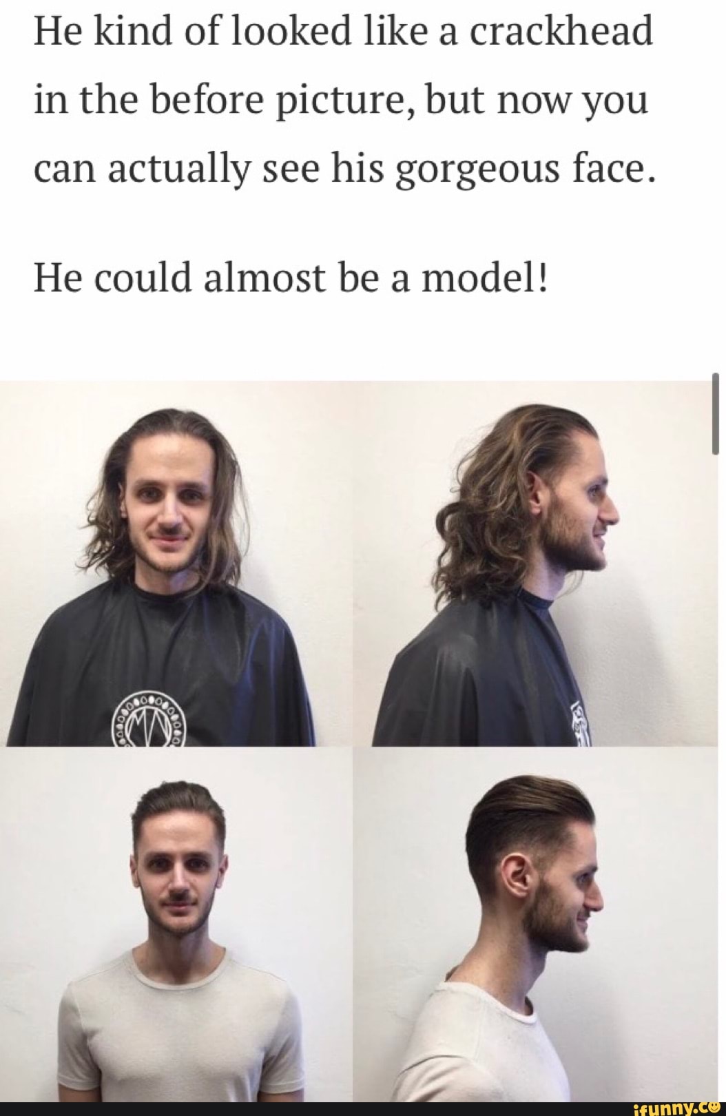 He kind of looked like a crackhead in the before picture, but now you ...