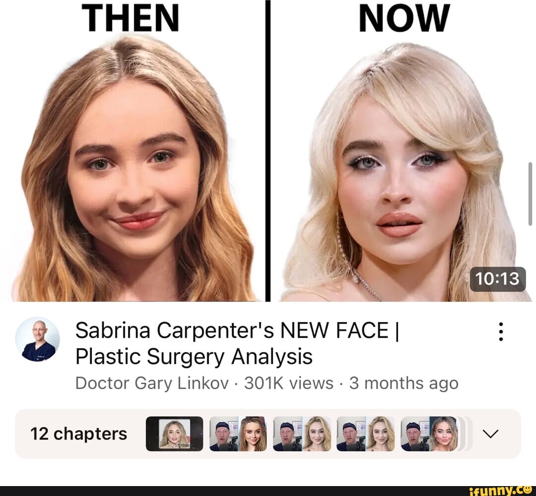 Sabrina Carpenter's NEW FACE I I Plastic Surgery Analysis Doctor Gary ...