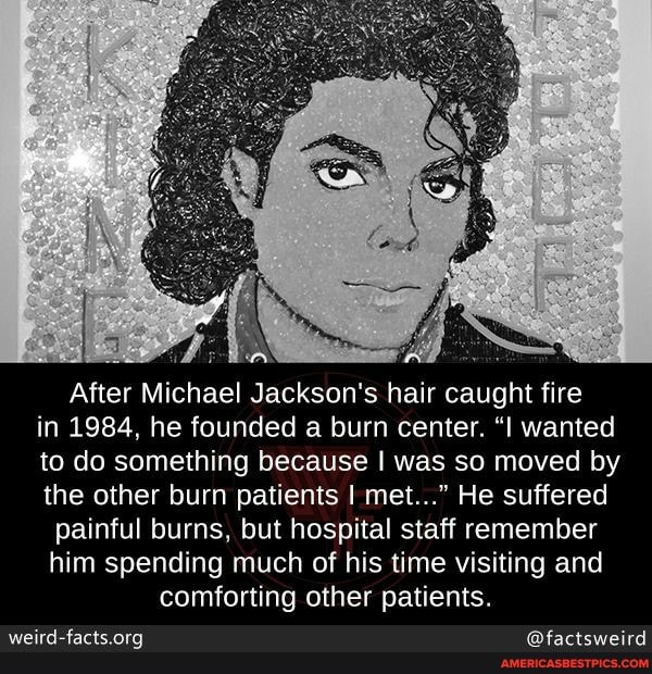 After Michael Jackson's hair caught fire in 1984, he founded a burn ...