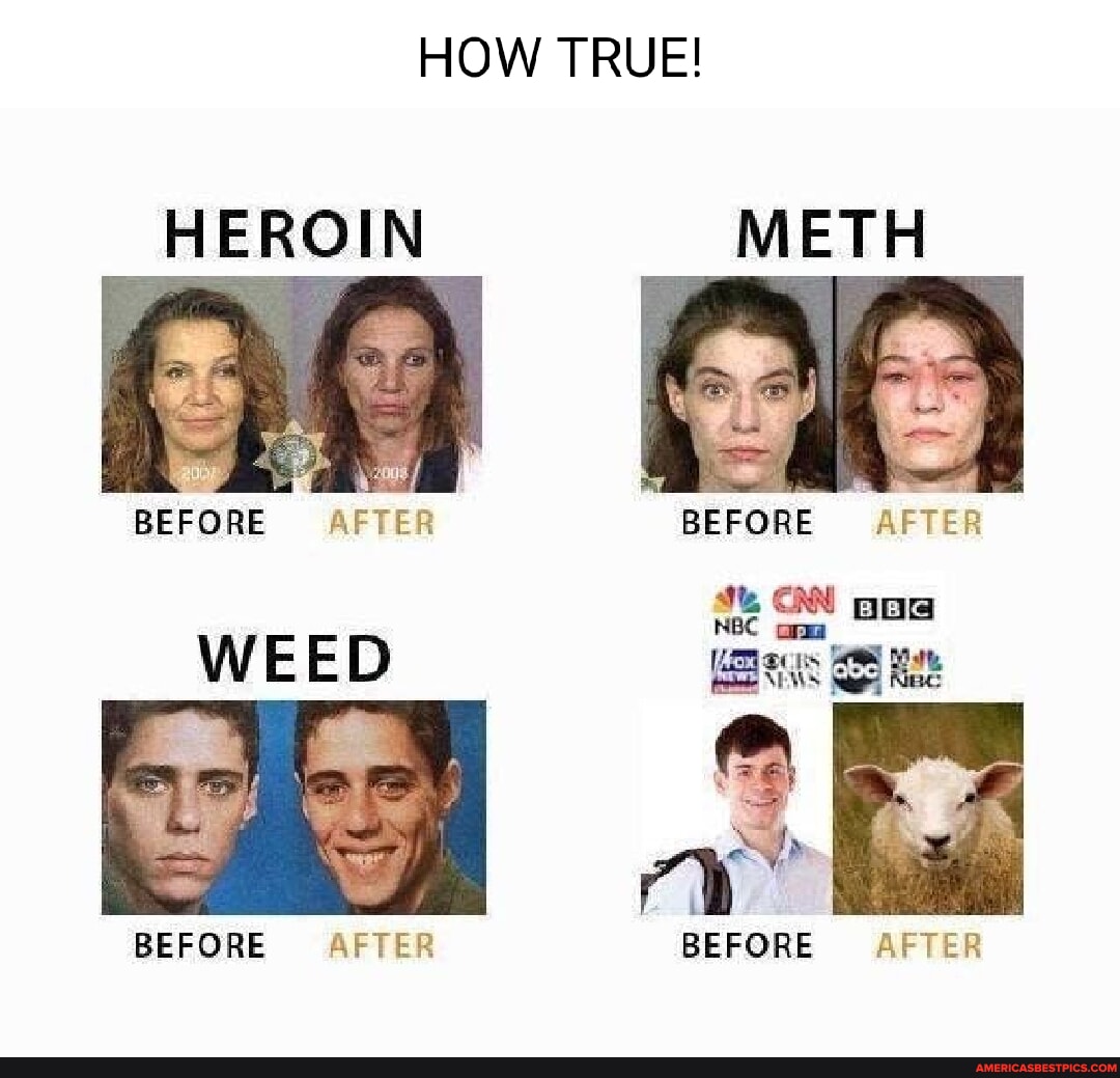 HOW TRUE! HEROIN METH BEFORE AFTER BEFORE ON po WEED BEFORE AFTER ...