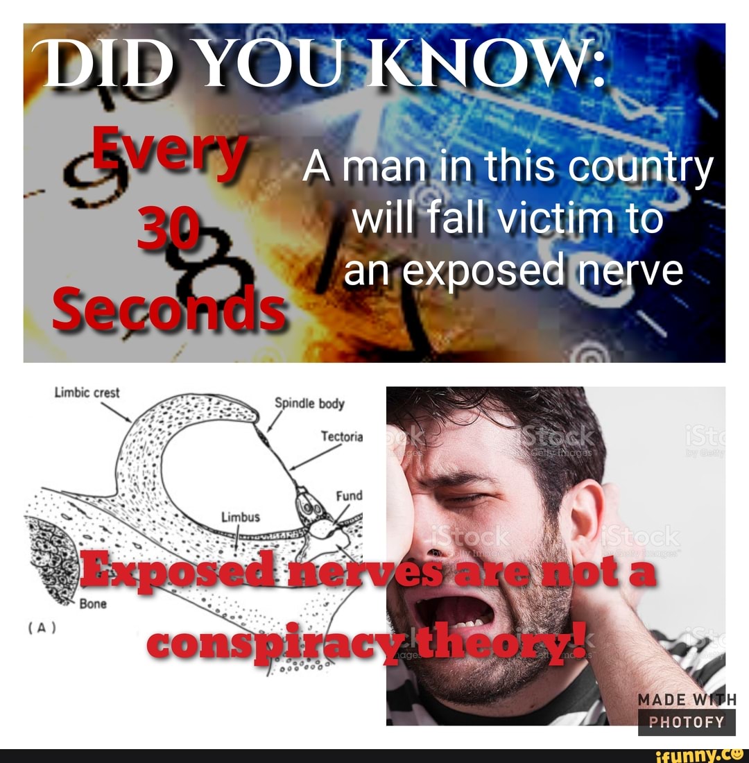 Exposednerve memes. Best Collection of funny Exposednerve pictures on ...