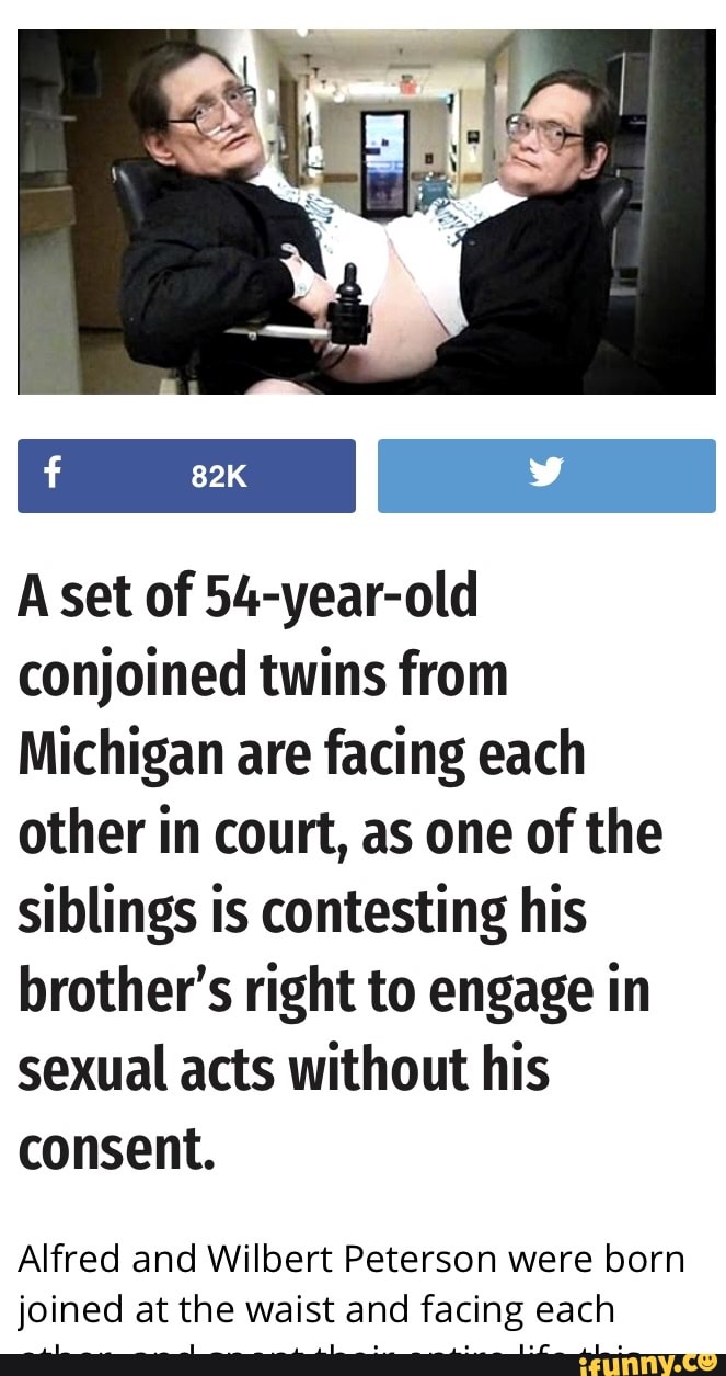It’s debate time Imgur - A set of 54-year-old conjoined twins from ...