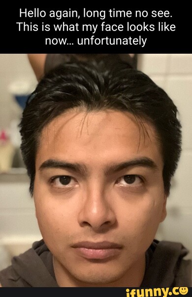 Hello again, long time no see. This is what my face looks like now ...