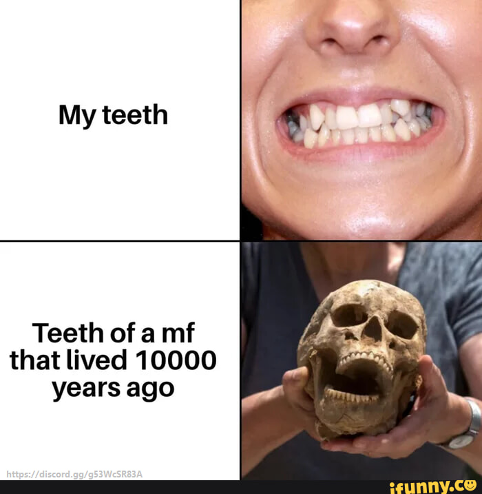 My teeth Teeth of a mf that lived 10000 years ago - iFunny