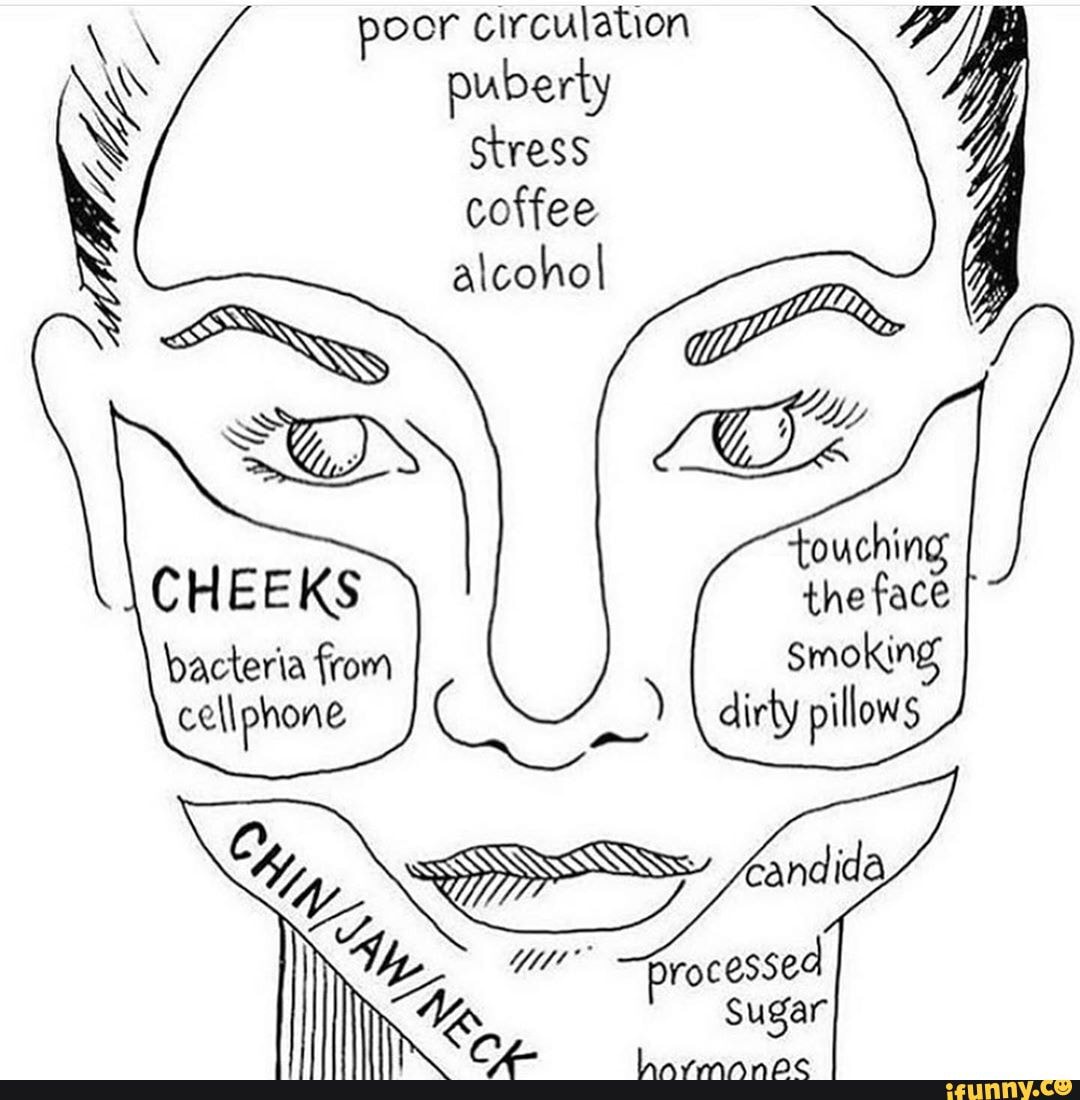 \ poor circulation \W puberty stress coffee alcohol 'touching the face ...