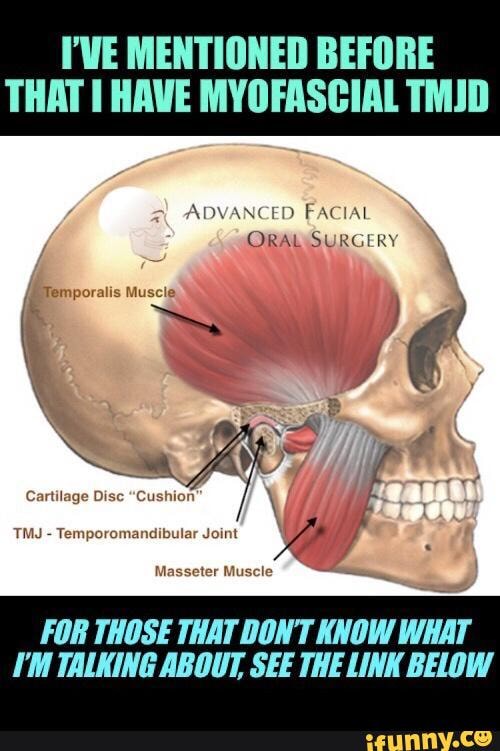 Myofascial memes. Best Collection of funny Myofascial pictures on iFunny
