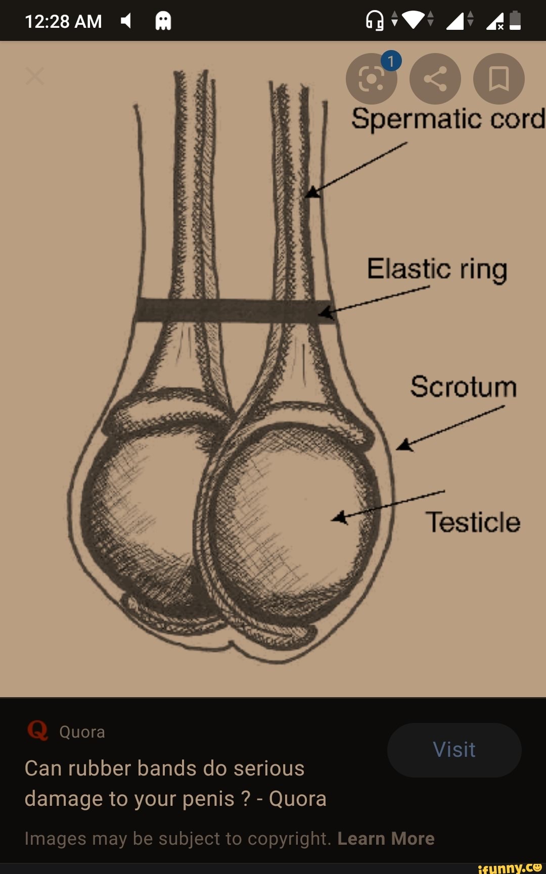AM AL Spermatic cord I Elastic ring Scrotum Testicle Quora Visit Can rubber bands do serious damage to your penis Quora Images may be subject to copyright. Learn More iFunny
