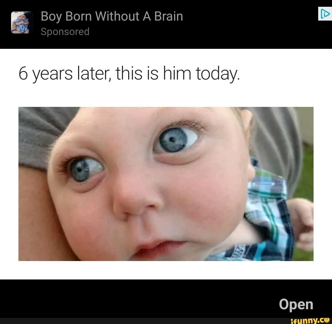 Boy Born Without A Brain Sponsored 6 years later, this is him today ...