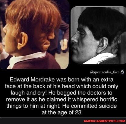 Fact Edward Mordrake was born with an extra face at the back of his ...