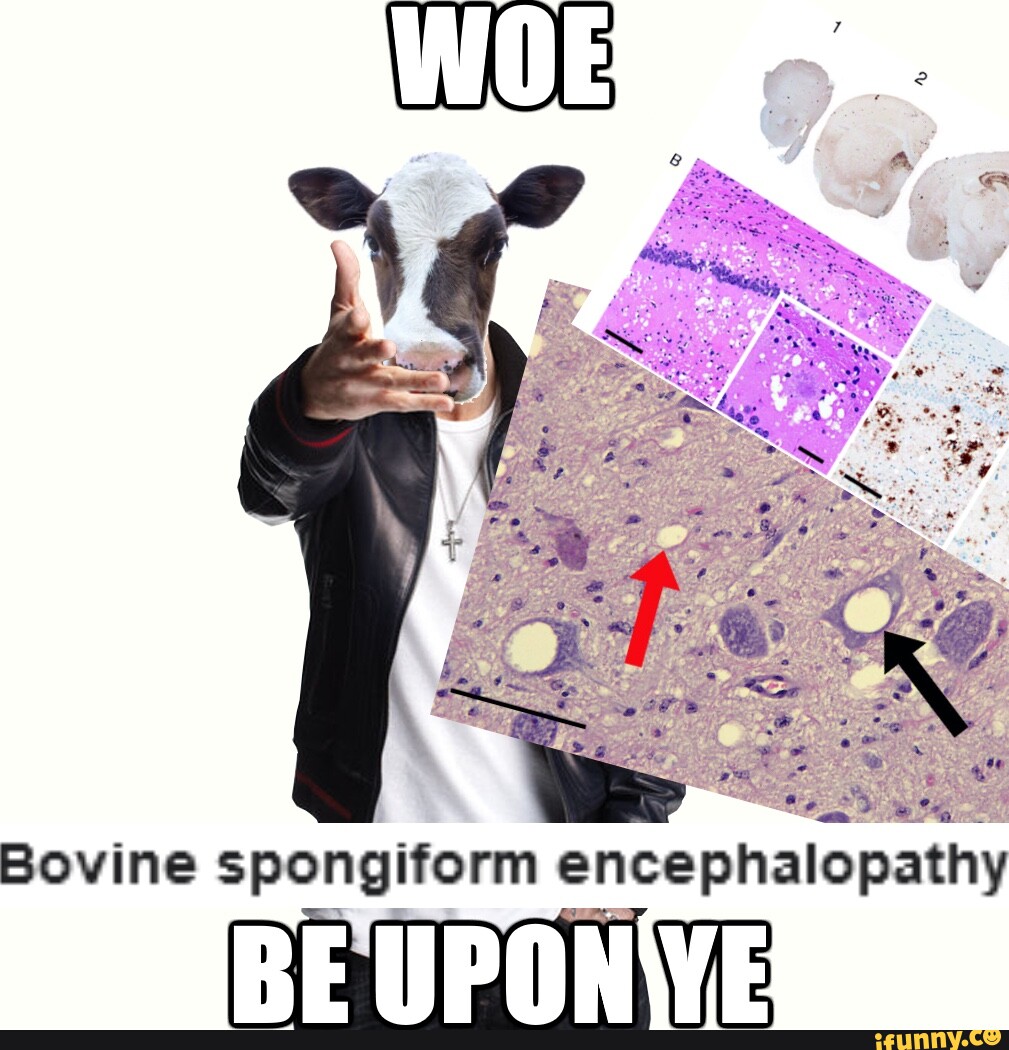 Bovine spongiform encephalopathy BE - iFunny