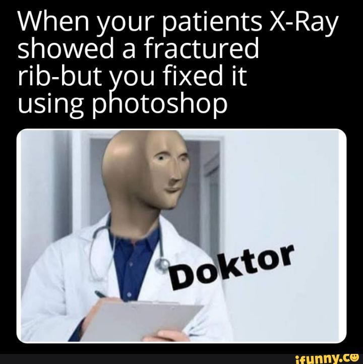 When your patients X-Ray showed a fractured rib-but you fixed it using ...