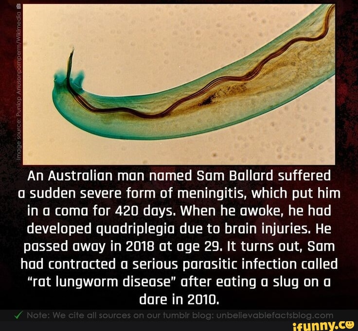 Meningitis memes. Best Collection of funny Meningitis pictures on iFunny