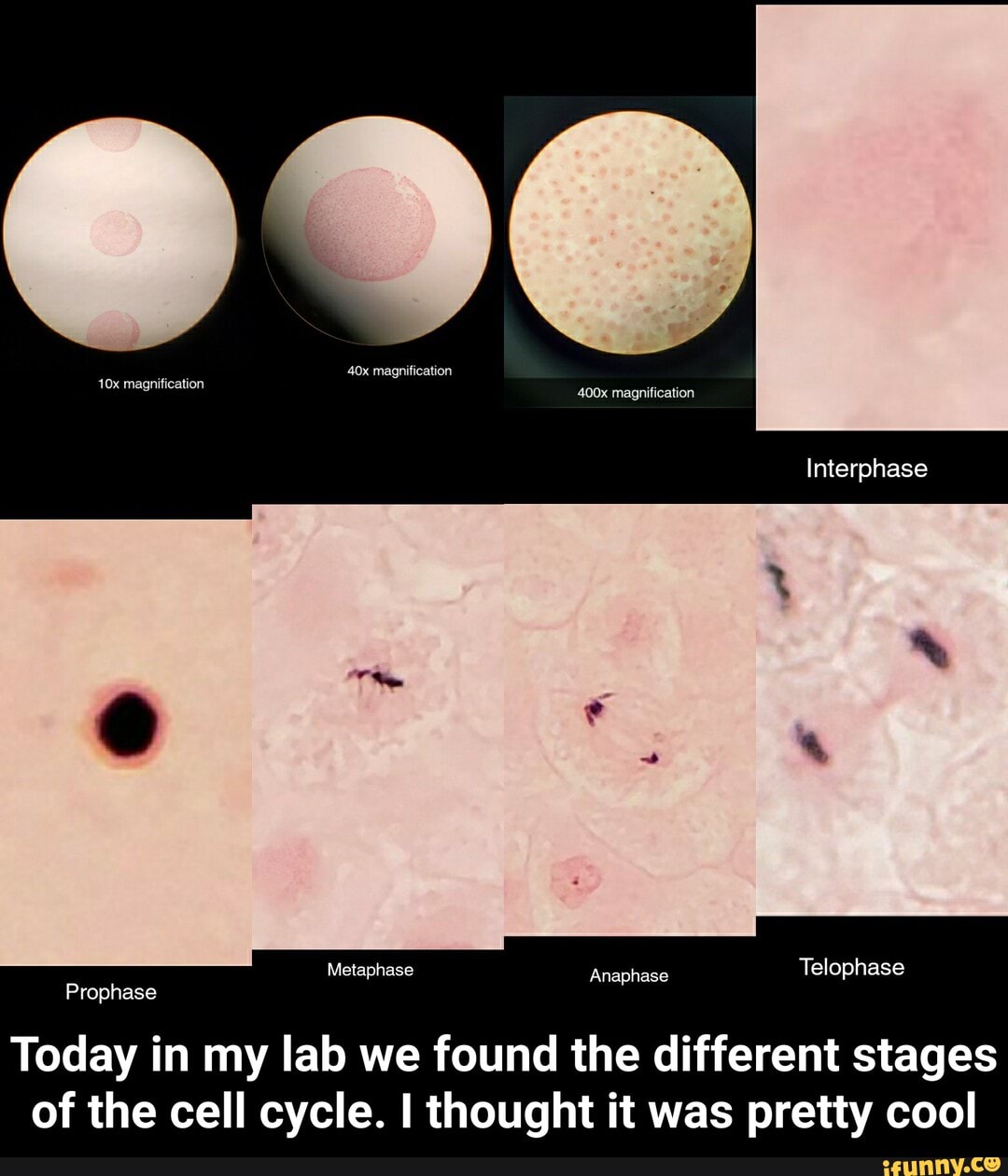 Interphase memes. Best Collection of funny Interphase pictures on iFunny