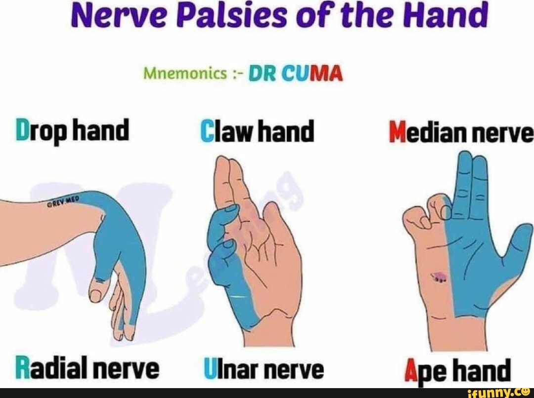 Nerve Palsies of the Hand Mnemonics DR CUMA Drop hand Claw hand Median ...