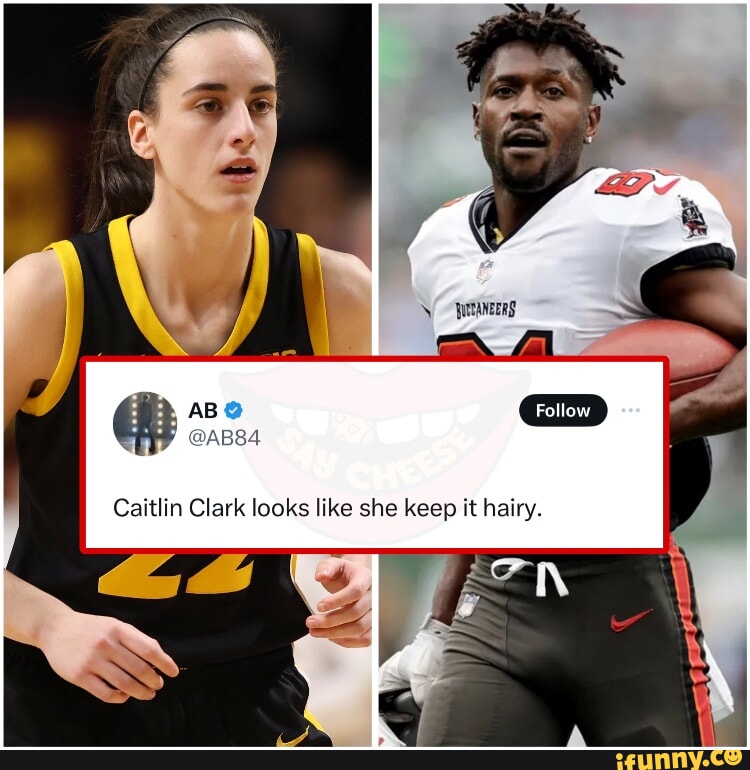 Caitlin Clark looks like she keep it hairy. - iFunny