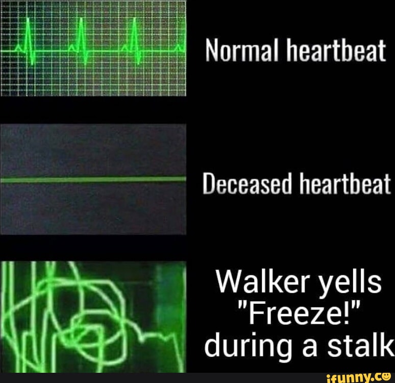 Normal heartbeat Deceased heartbeat Walker yells "Freeze!" during a ...