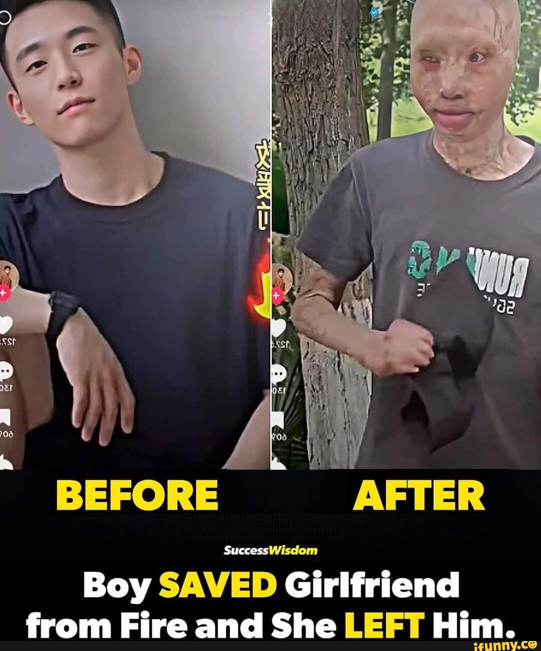 BEFORE AFTER Success Wisdom Boy SAVED Girlfriend from Fire and She LEFT Him. - iFunny
