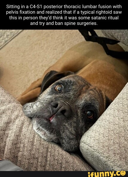 Sitting in a C4-S1 posterior thoracic lumbar fusion with pelvis ...