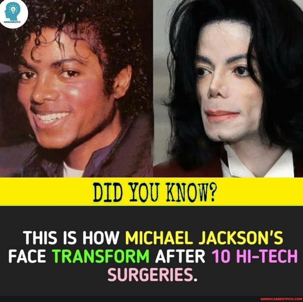 DID YOU KNOW? THIS IS HOW MICHAEL JACKSON'S FACE TRANSFORM AFTER 10 HI ...