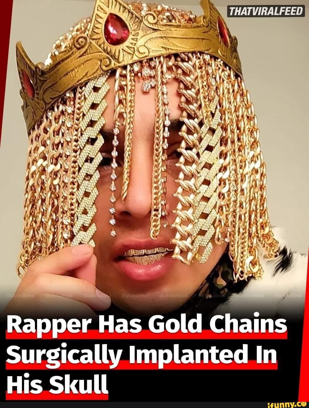 THATVIRALFEED - ' "y ' i at * ' ' ' Rapper Has Gold Chains Surgically ...