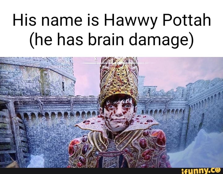 His name is Hawwy Pottah (he has brain damage) - iFunny