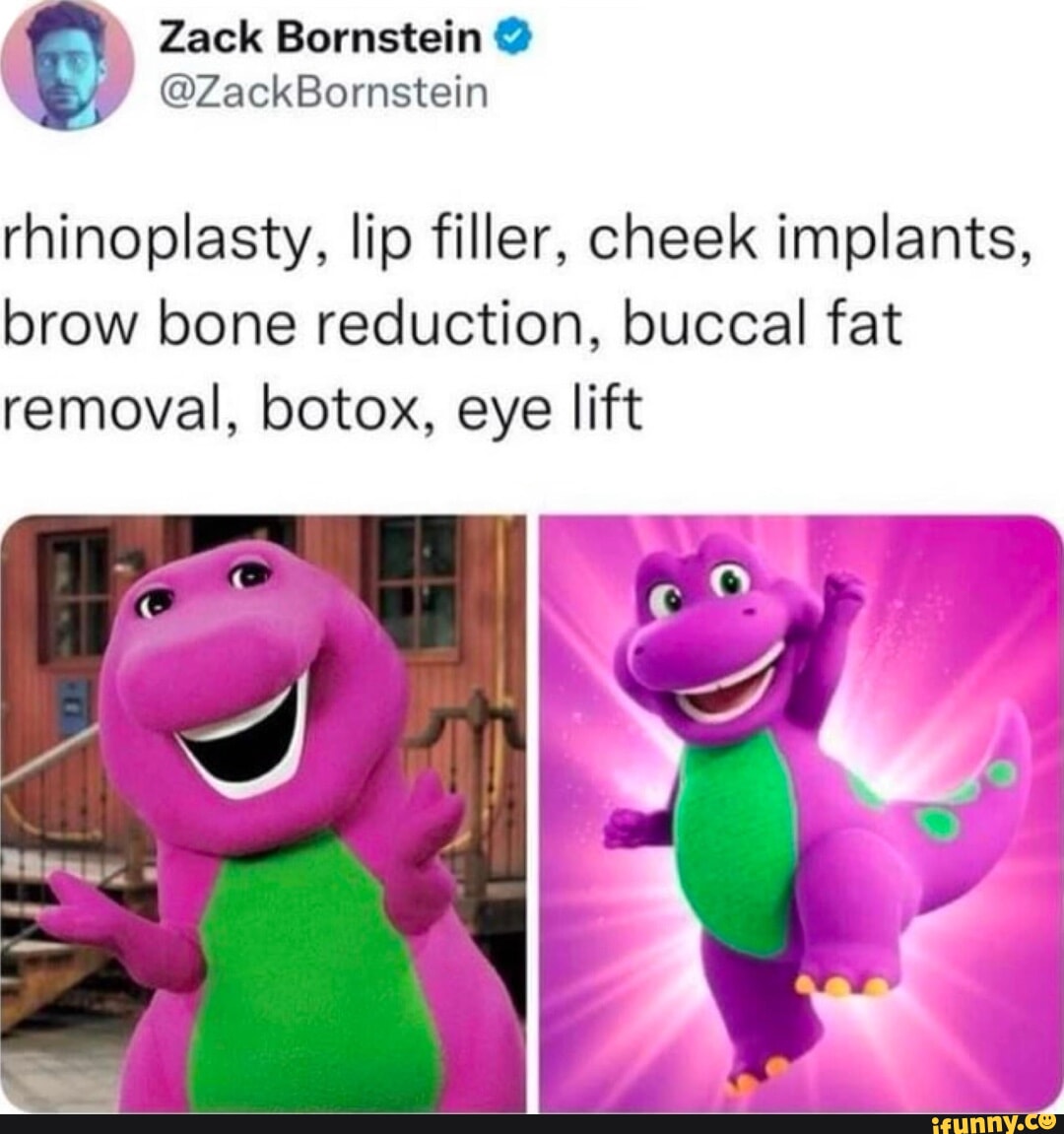 Rhinoplasty memes. Best Collection of funny Rhinoplasty pictures on iFunny