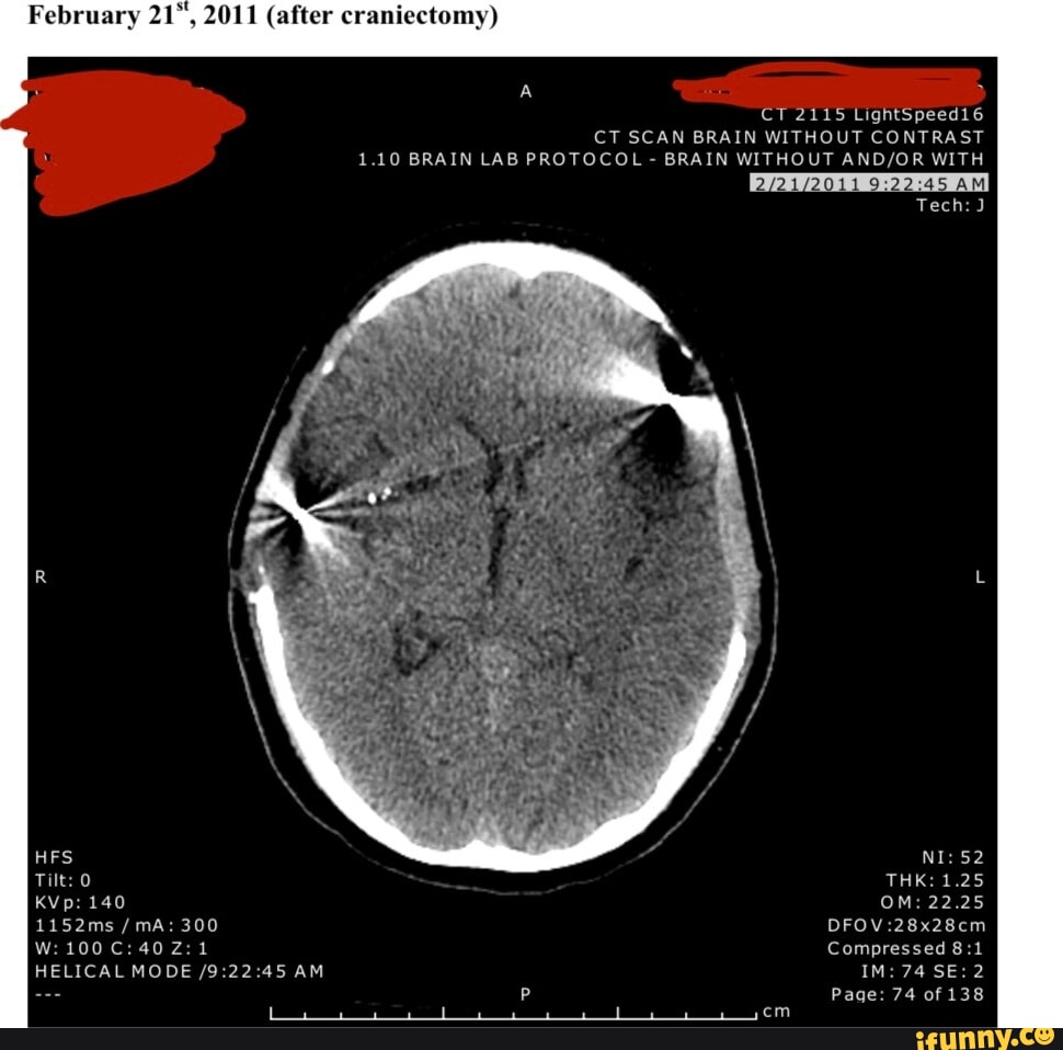 Compressed memes. Best Collection of funny Compressed pictures on iFunny