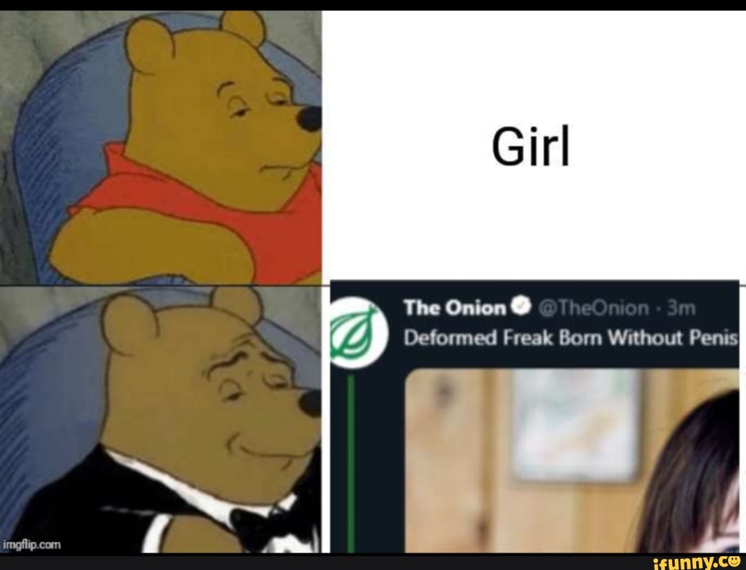 Deformed Freak Born Without Penis - iFunny