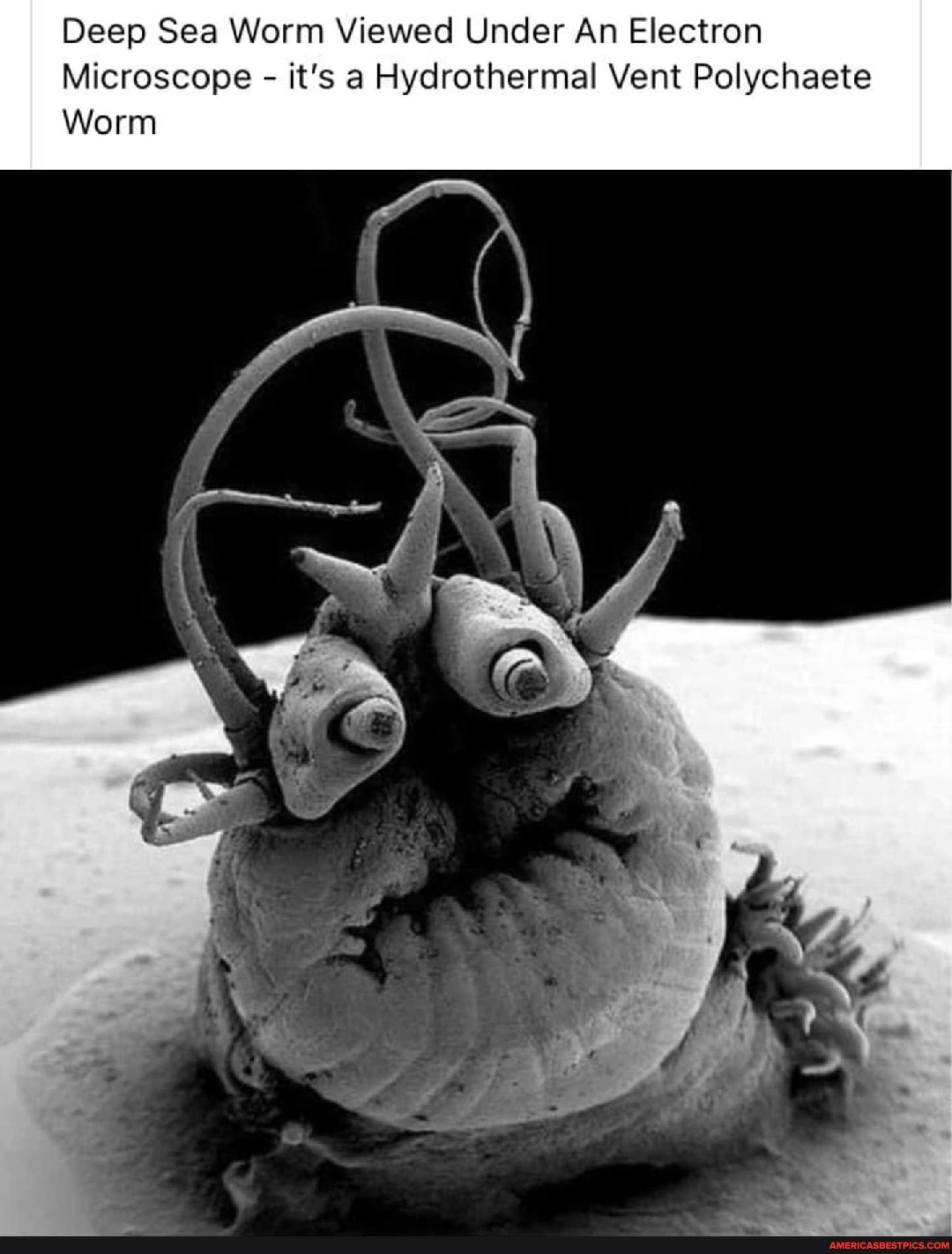 Deep Sea Worm Viewed Under An Electron Microscope - it's a Hydrothermal ...