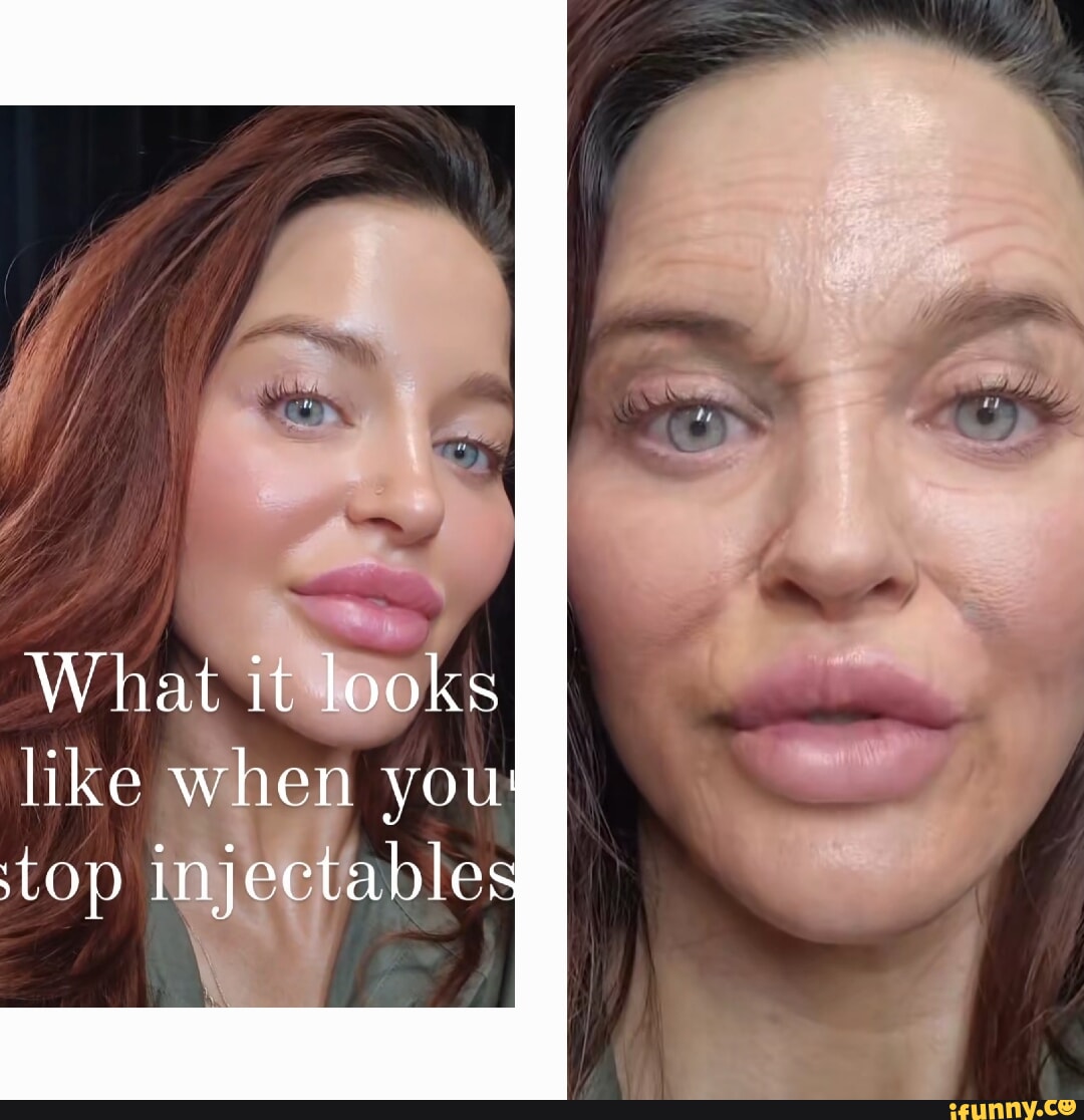 Injectables memes. Best Collection of funny Injectables pictures on iFunny