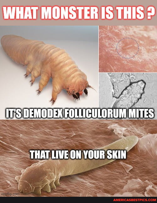 WHAT MONSTER IS THIS I IT'S DEMODEX FOLLICULORUM MITES THAT LIVE ON ...