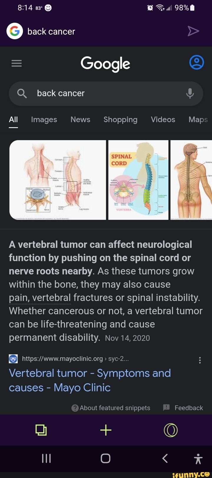 Vertebral memes. Best Collection of funny Vertebral pictures on iFunny