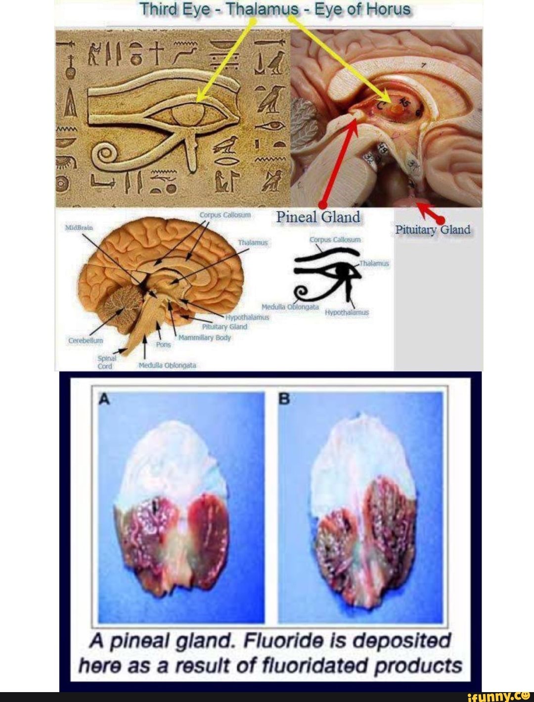 Eye Of Horus Pineal Gland