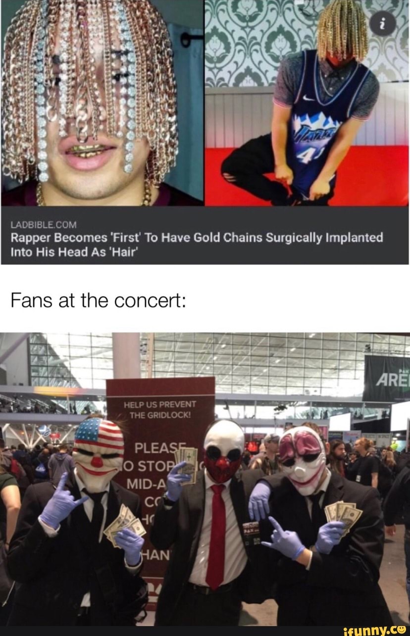 Rapper Becomes 'First' To Have Gold Chains Surgically Implanted Into ...