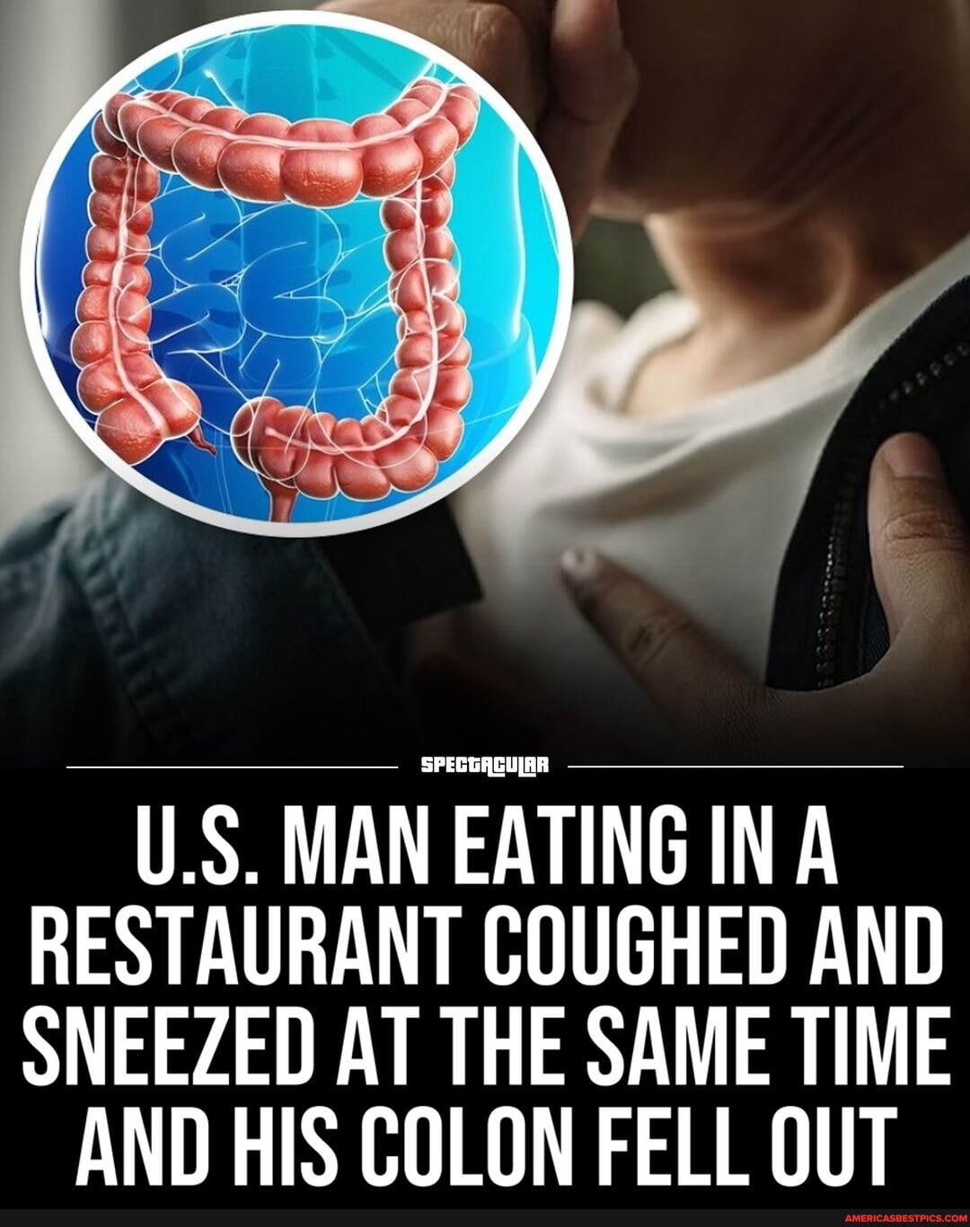 A 63-year-old man experienced a shocking medical emergency while having ...