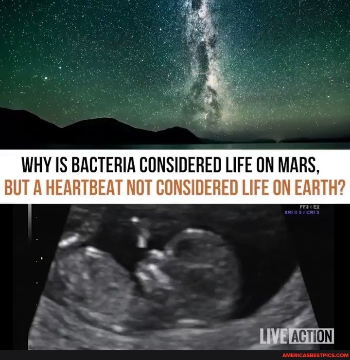 WHY IS BACTERIA CONSIDERED LIFE ON MARS, BUT A HEARTBEAT NOT CONSIDERED ...