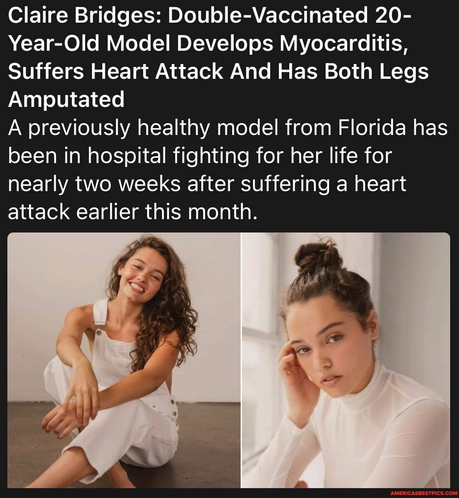 Claire Bridges: Double-Vaccinated 20- Year-Old Model Develops ...