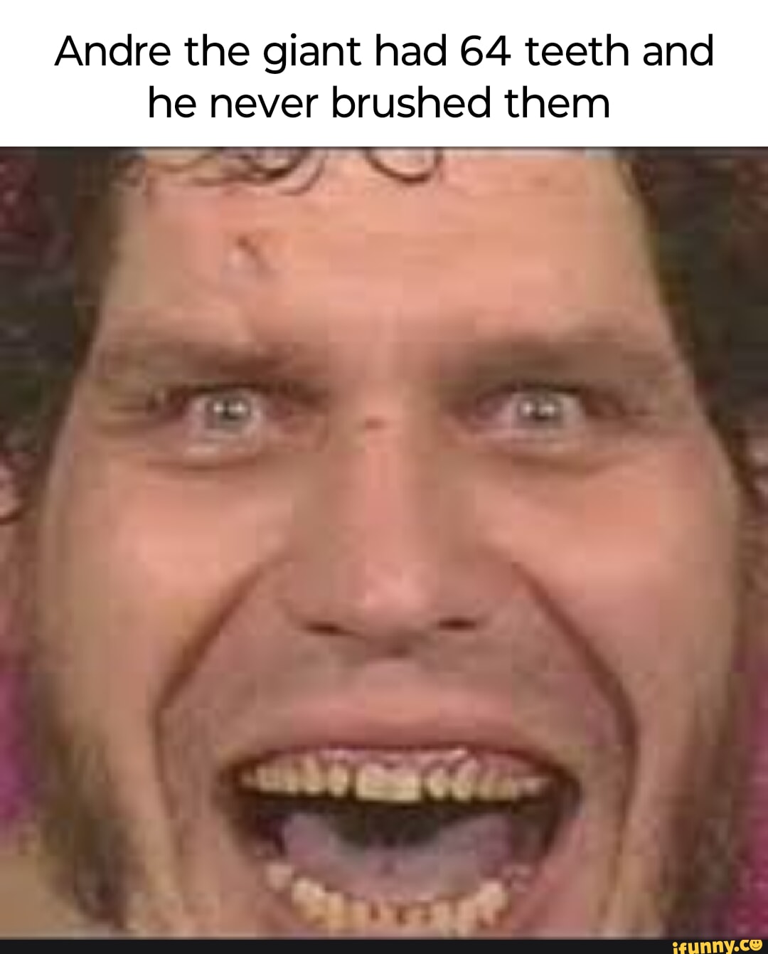 Andre the giant had 64 teeth and he never brushed them - iFunny