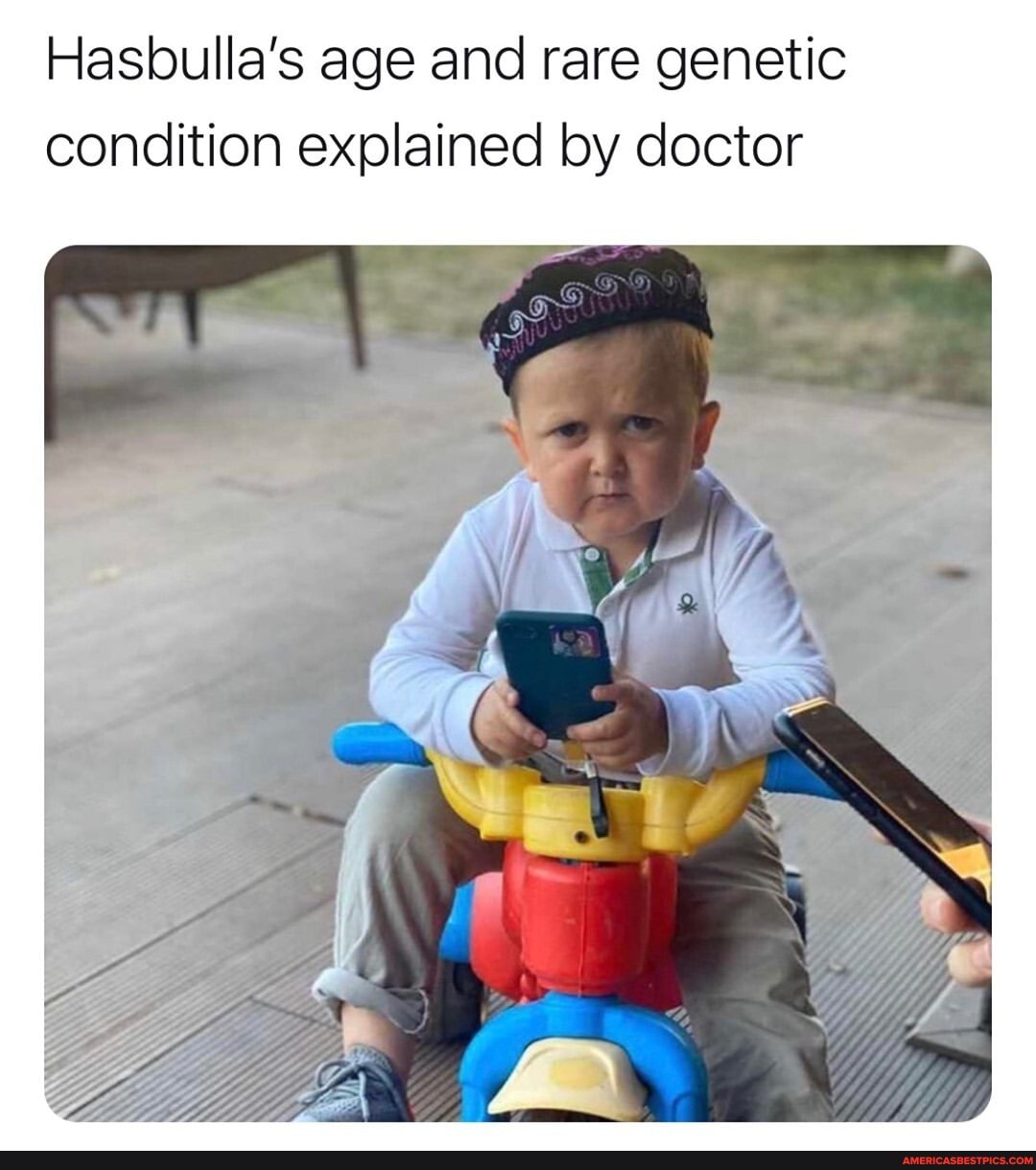 Hasbulla's age and rare genetic condition explained by doctor - America ...